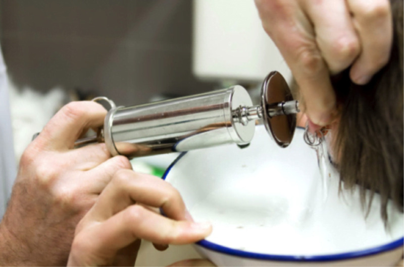 Tappo di Cerume: come eseguire corretamente il lavaggio - Maurizio G ...